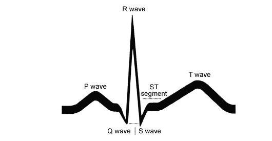 Normal Electrocardiogram Tracing